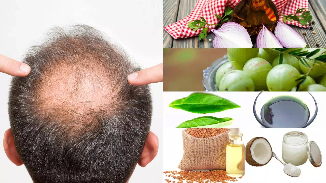 5 Best Home Remedies For Hair Fall In Hindi Hair Care Tips क्या तेजी
