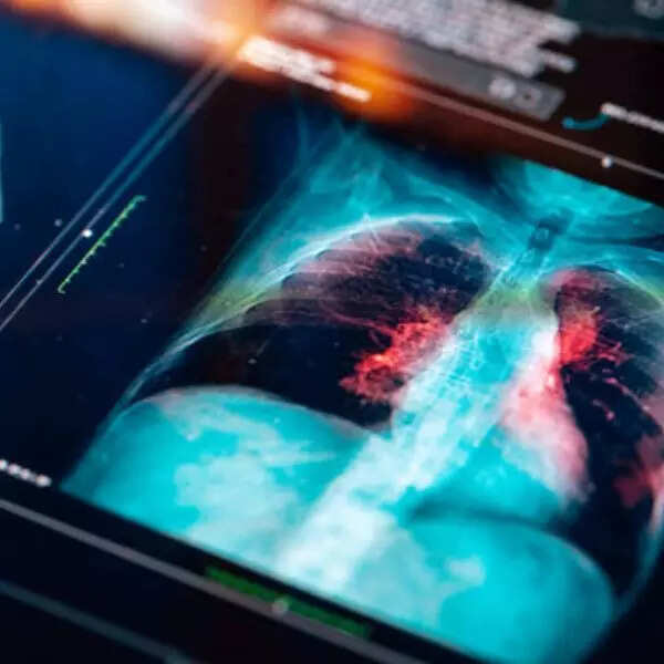 Can a Person Survive with the help of one Lungs Know How to Keep Fit