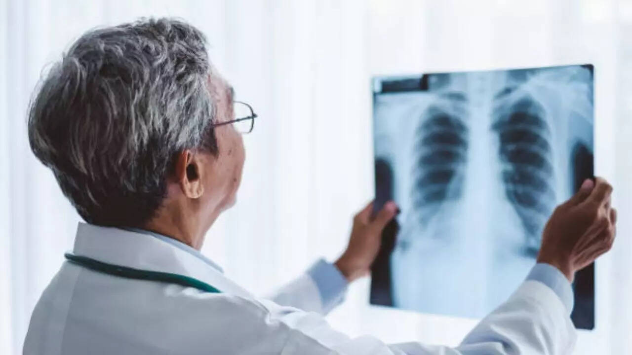 X-Ray Invention Story In Medical History:discovery of X-ray is ...