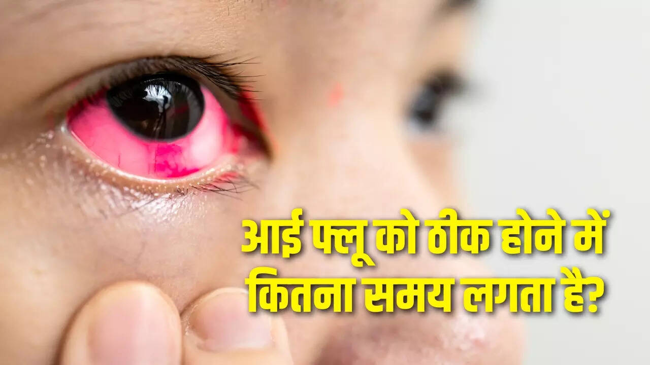 Eye Flu Kitne Din Me Thik Hoga, Eye Flu Kaise Hote Hai, Kaise Failta Hai, Bachne Ke Upay in ...
