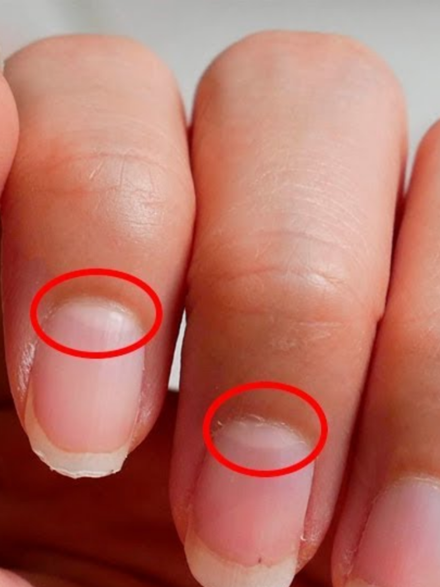 What is the white part between the finger nails called | Times Now ...
