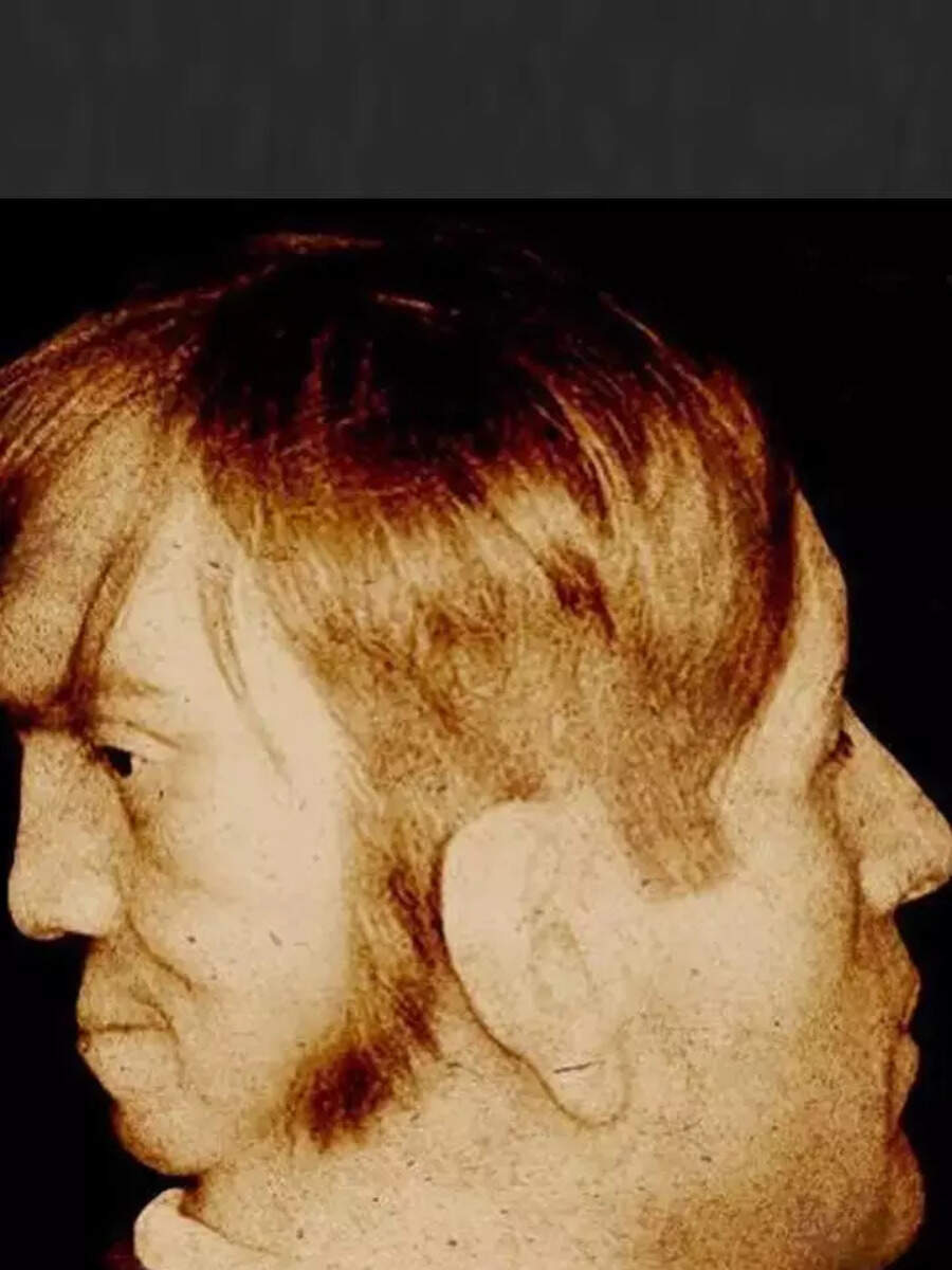 edward mordrake was only two face man in the world see photos - या माणसाला होती 2 तोंडं, पाहा ...