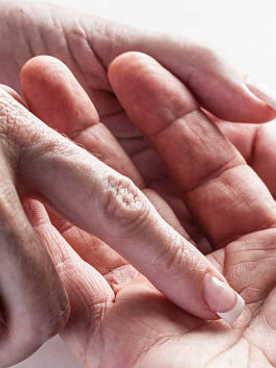 Mole On Palm: Do you have a mole on your palm, then know its meaning ...