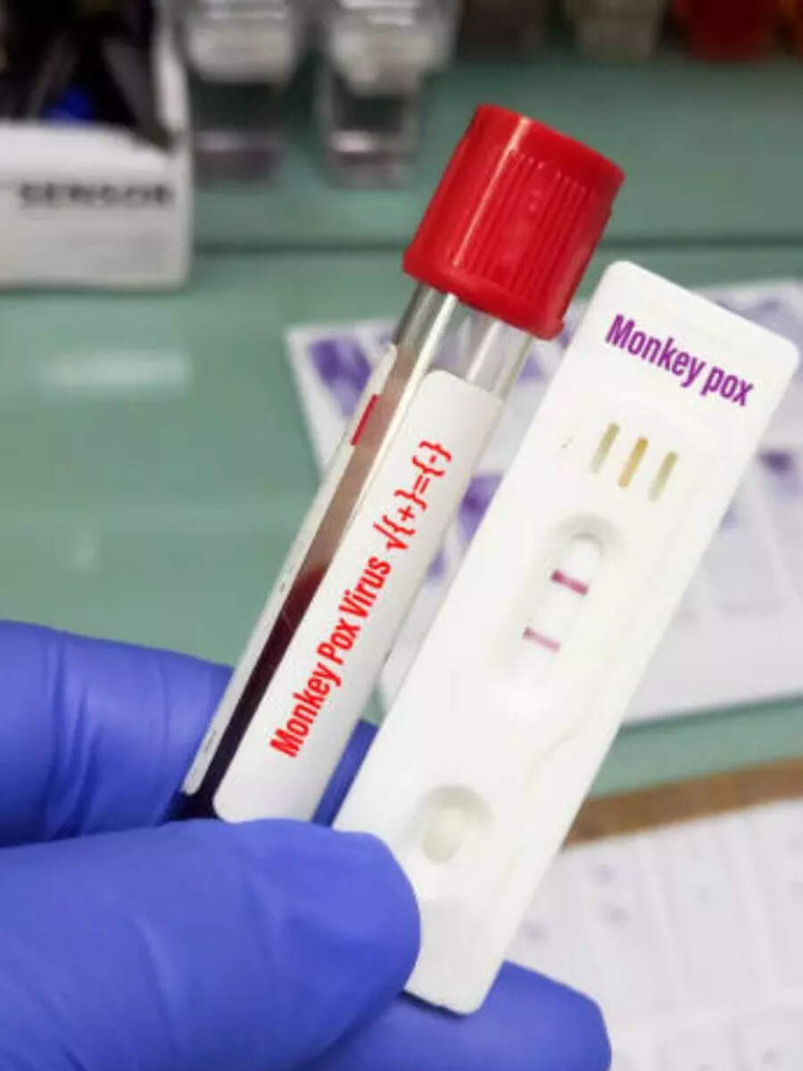 How To Prevent Dengue In Monsoon Check Tips Here | Times Now Navbharat