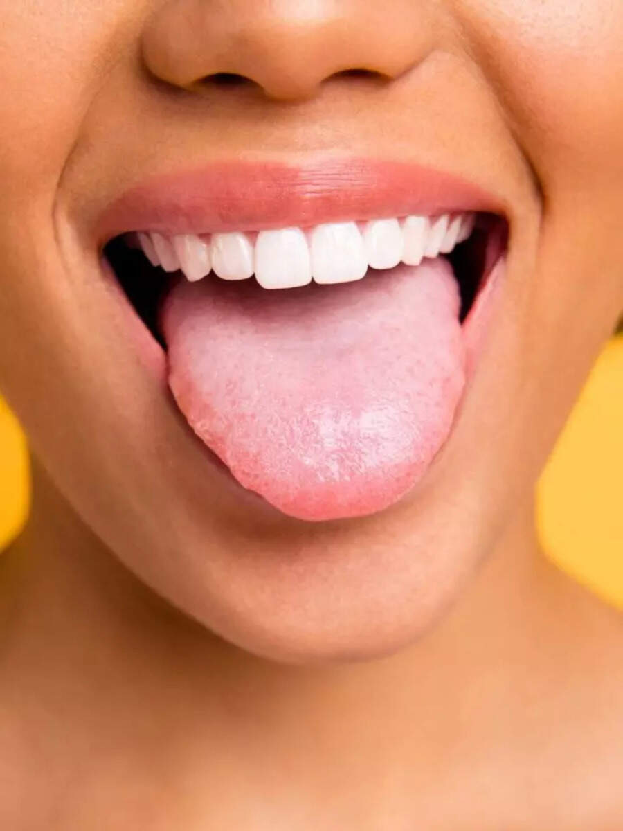 Tongue Color जीभ बताती है सेहत का हाल जानें आप हेल्दी हैं या नहीं