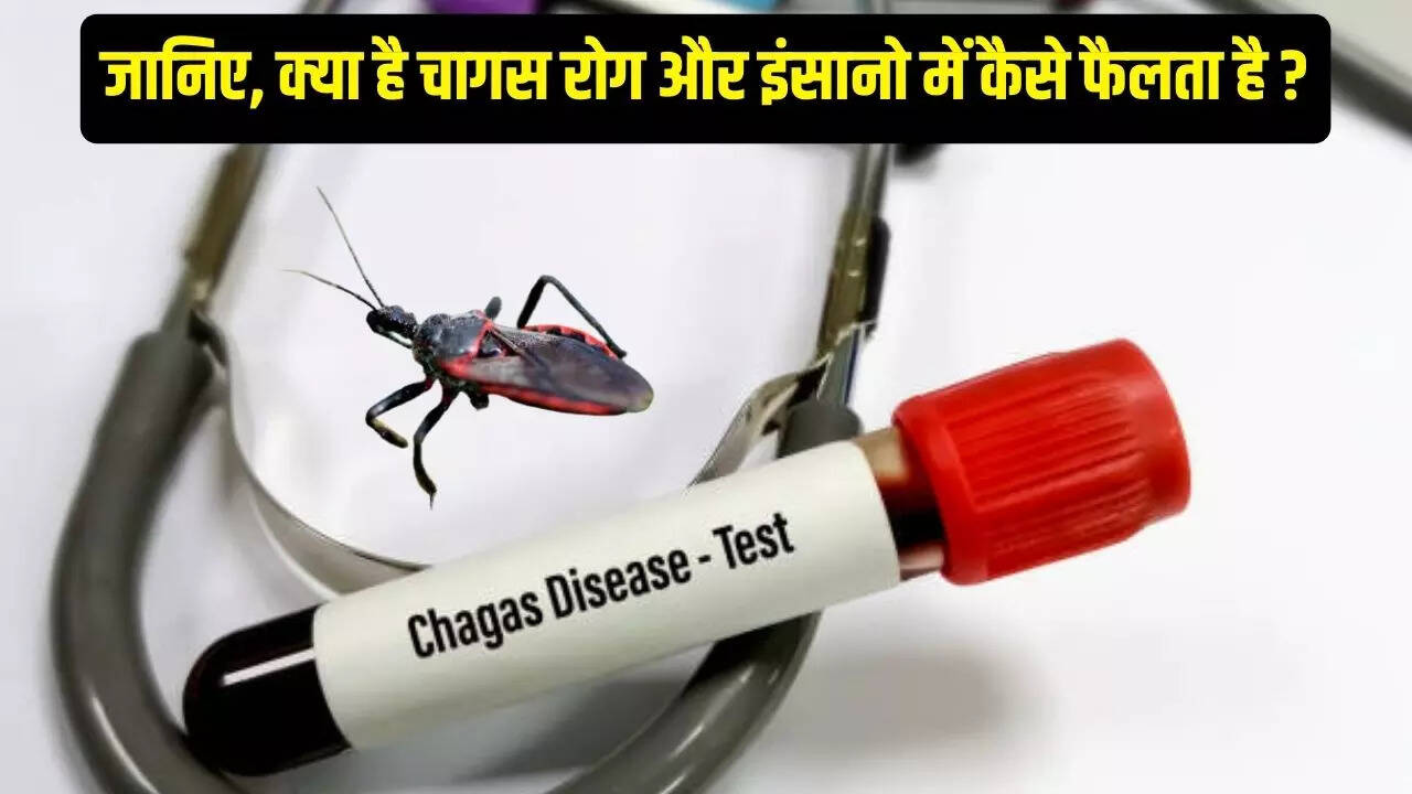 What is Chagas disease and how can humans get infected by it; Know from ...